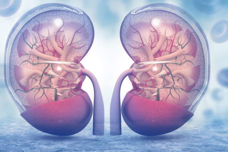 Nierensteine: Ursache, Symptome und Therapie - eMEDI