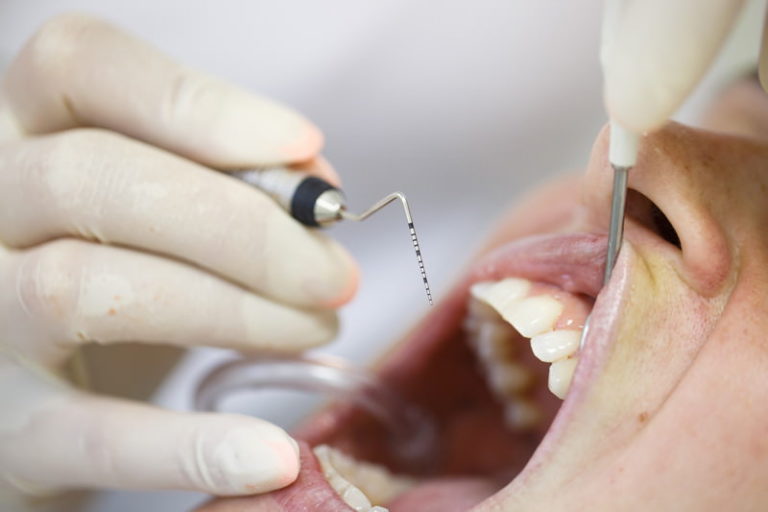 Parodontose: Ursachen, Symptome und Behandlung - eMEDI