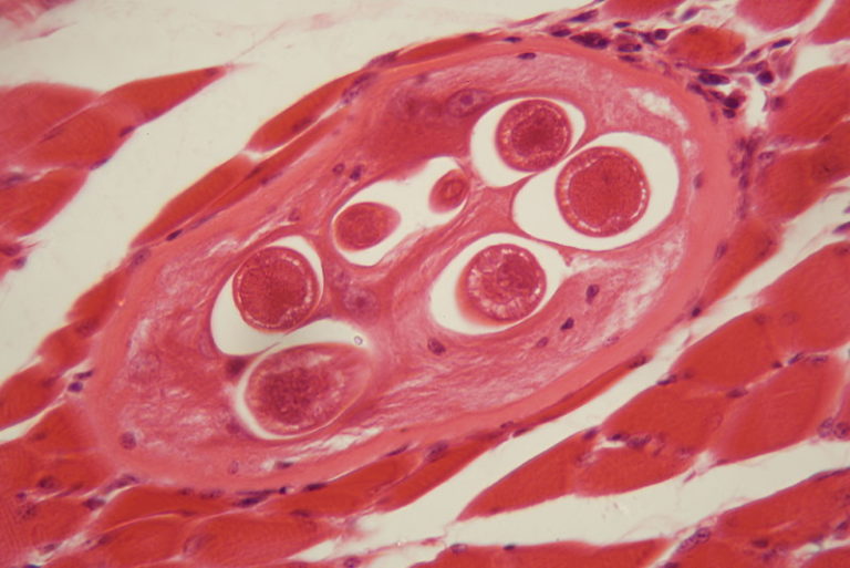 Trichinen (Trichinella): Symptome und Behandlung beim Menschen